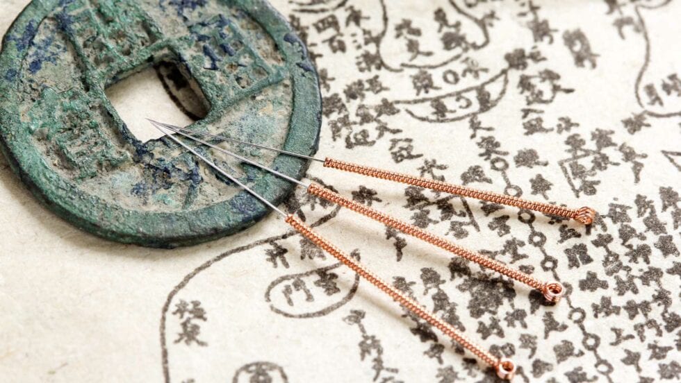 How do Acupuncturist Choose Acupuncture Points