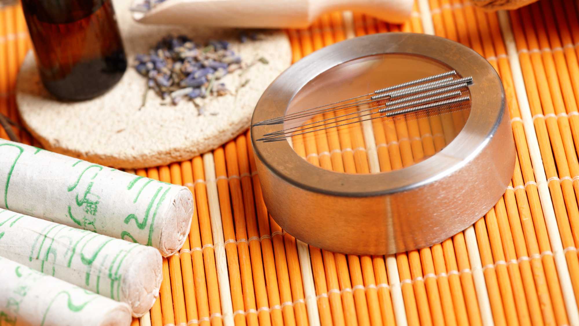 Experience Acupuncture Treatments for A True, Deep Level of Healing